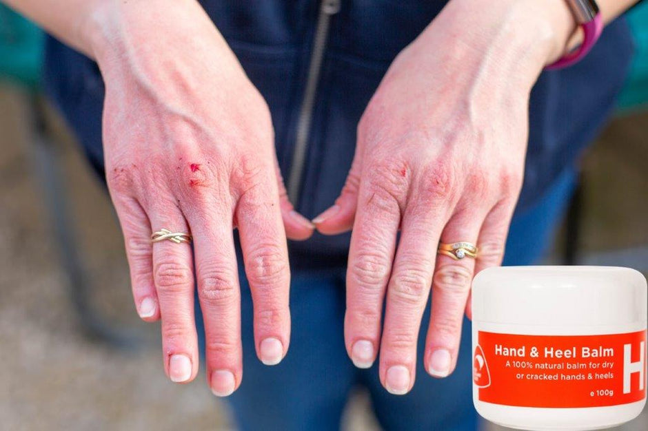 Rocket Fuel By Savvy Touch | 100% Natural | Supports A Clear & Healthy ...